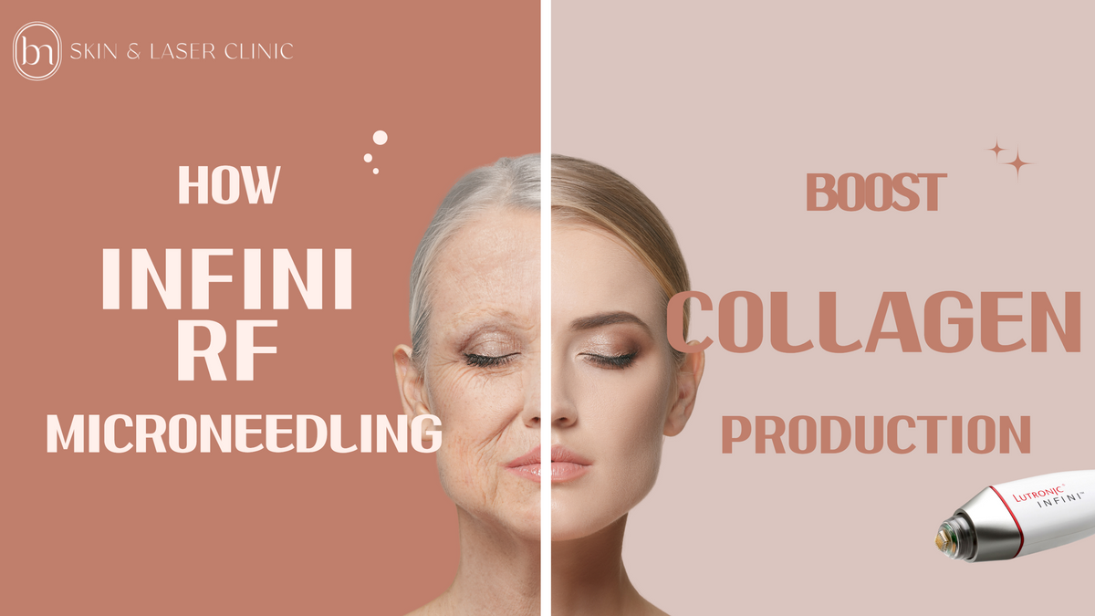 Unlocking the Science of Collagen and Anti-Aging: How Infini RF Micron